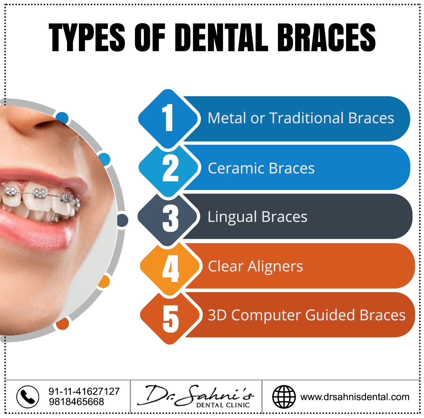 What are the Dental Braces and Retainers - Types, Cost, Care - All you ...