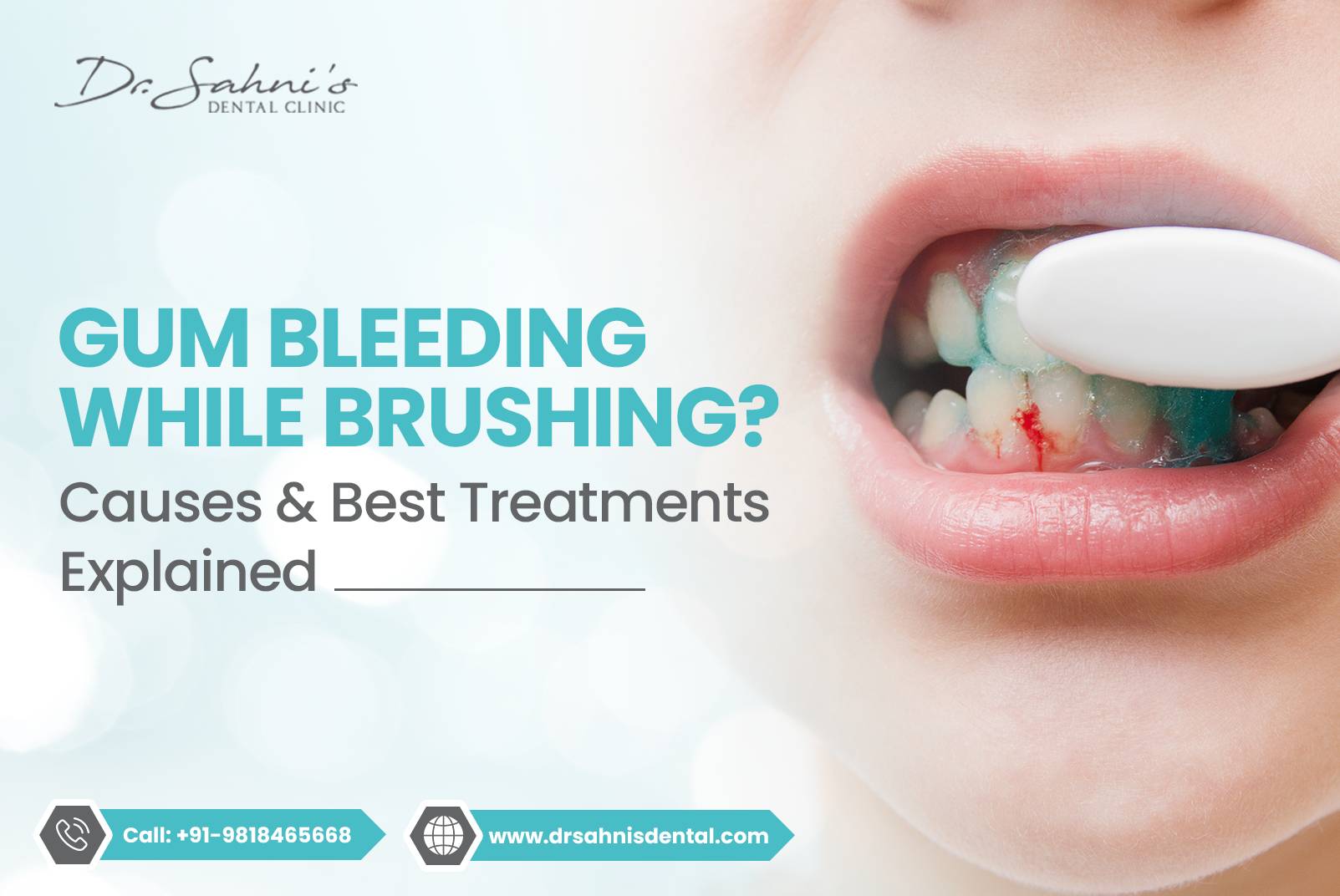 Gum Bleeding While Brushing? Causes & Treatments